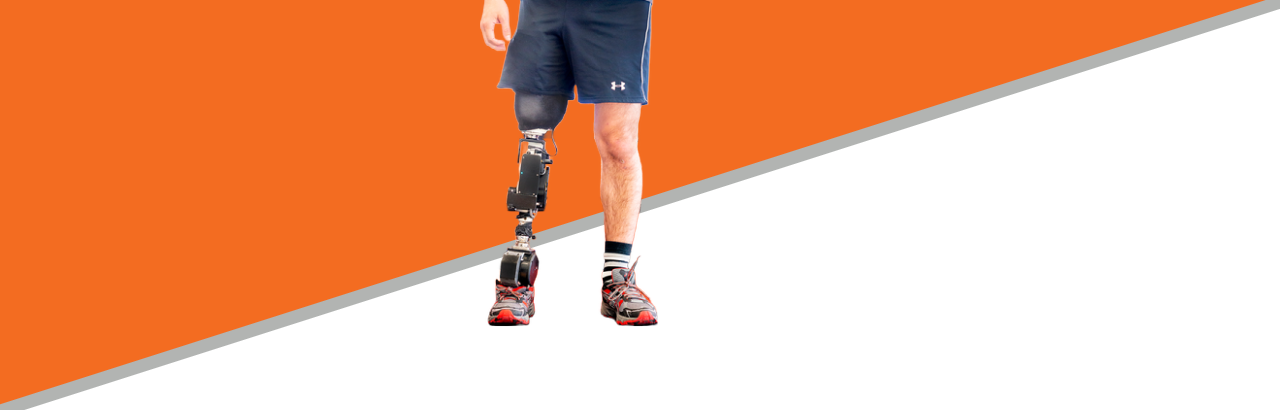 Open Source Bionic Leg