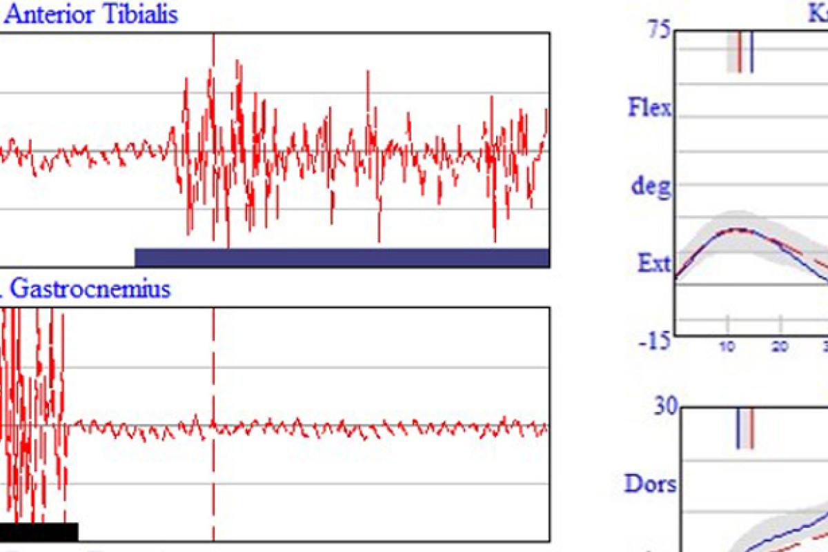 Computerized Motion Analysis For Clinicians